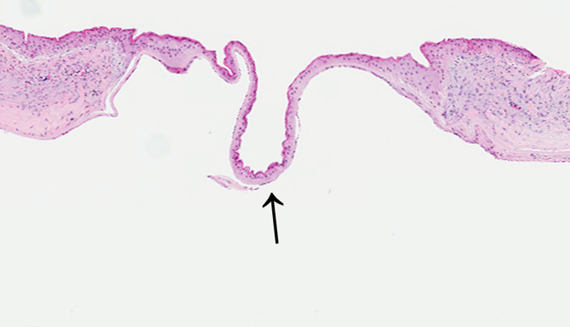 Case 17