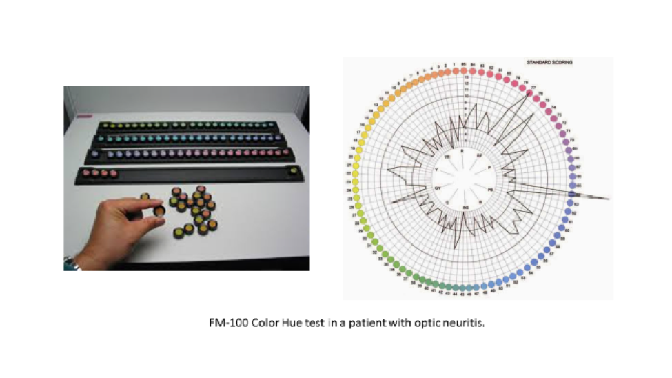 UW Special Testing - UW DOVS