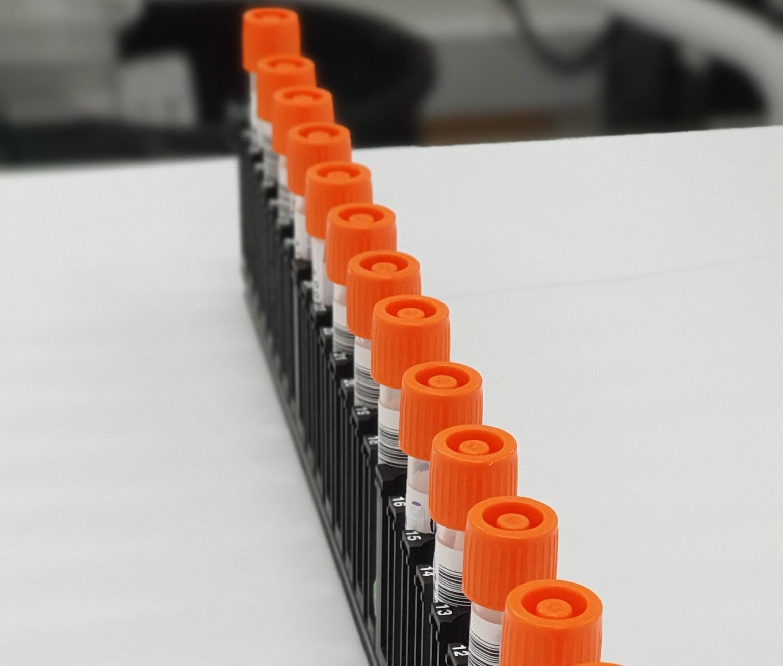 UW-Madison Launches New Ophthalmology Tissue Biobank – Ophthalmology ...