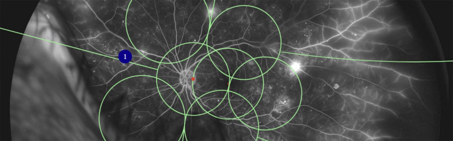 Wisconsin Reading Center – Ophthalmology and Visual Sciences – UW–Madison