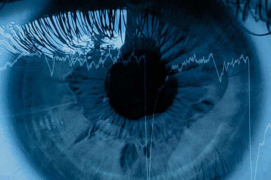 Neuro-Ophthalmology – Ophthalmology and Visual Sciences – UW–Madison